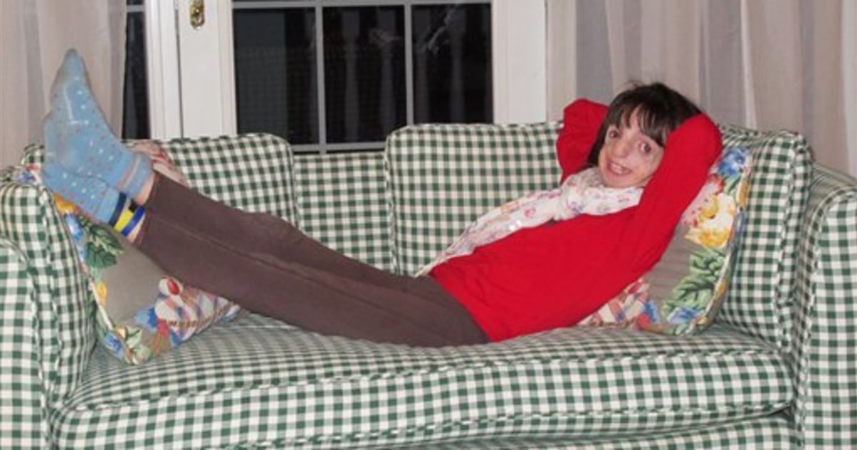 Girl with deformed face wants to be like other kids