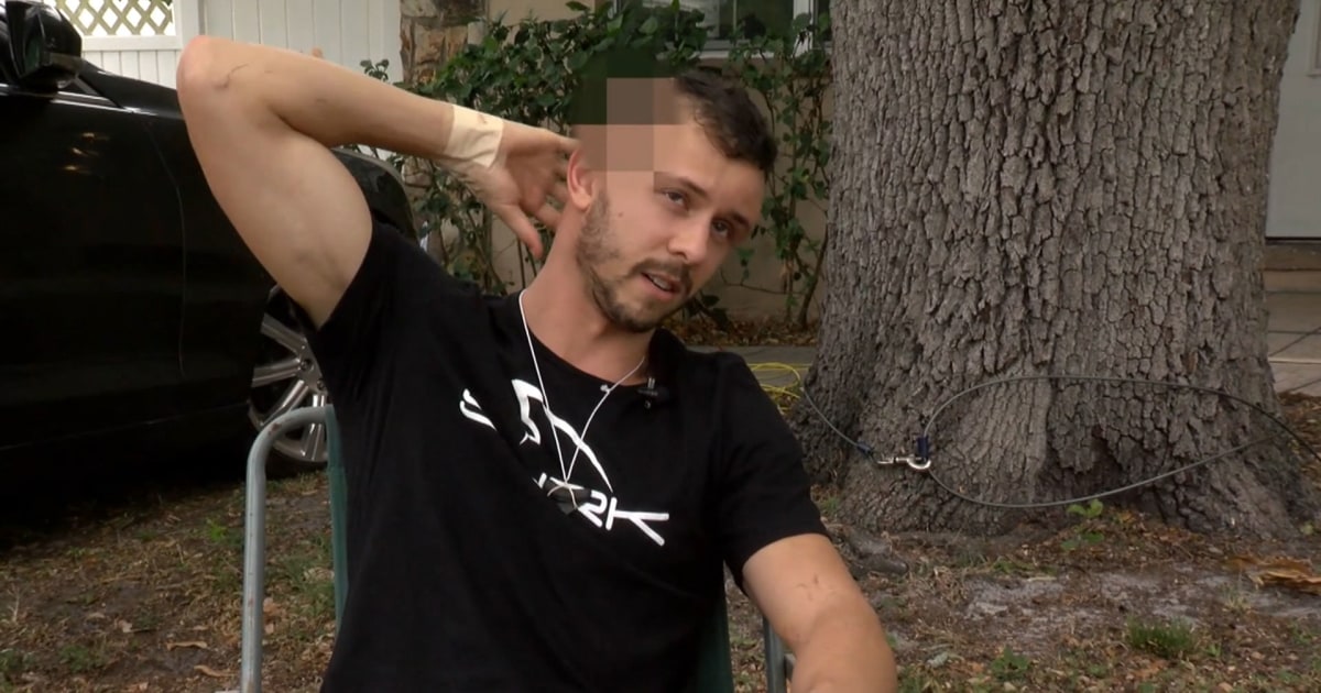 Florida man describes being attacked by alligator in Myakka River