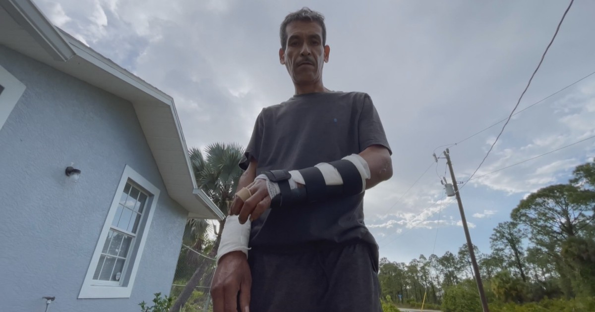 Florida man describes tiger attack that nearly claimed his life
