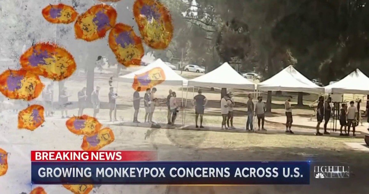 U.S. struggles to roll out enough monkeypox vaccines as cases surge