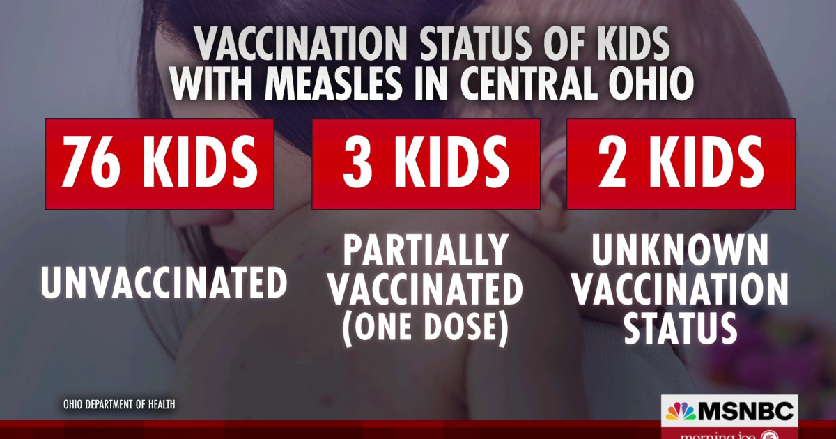 Measles Outbreak in Ohio: 81 kids infected so far