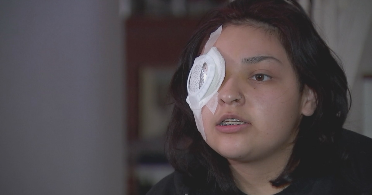 California fast food worker to lose eye after customer attack