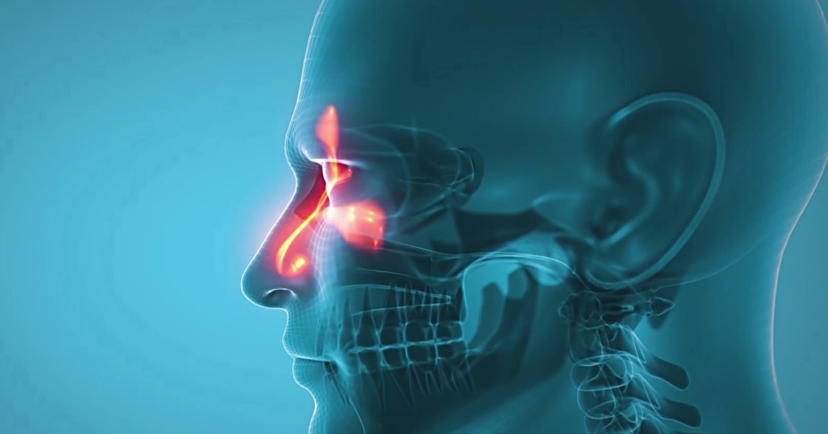 Virginia researchers work on solution for loss of smell from Covid ...