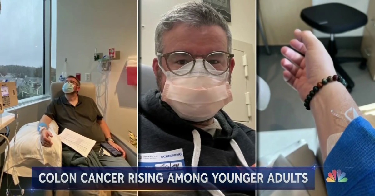 Colorectal cancer rates in younger Americans on the rise