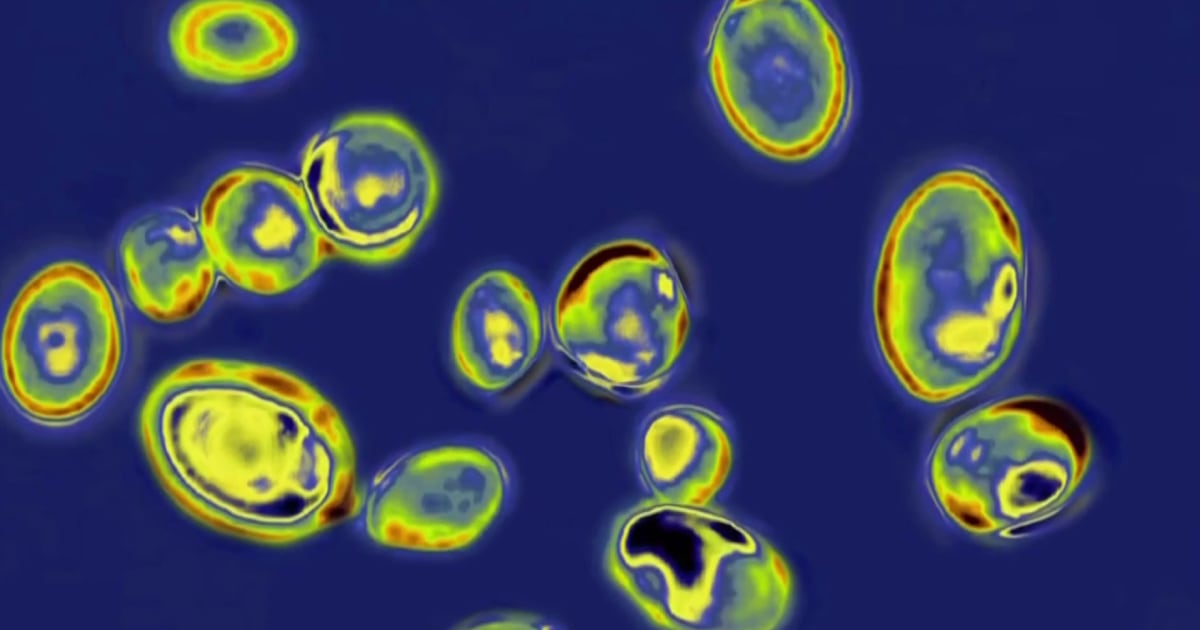 CDC warns of spike in U.S. cases of deadly fungal infection