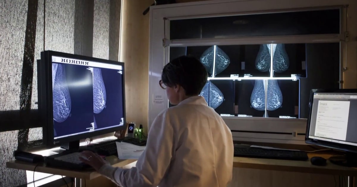 Women should get screened for breast cancer at 40 rather than 50, new ...