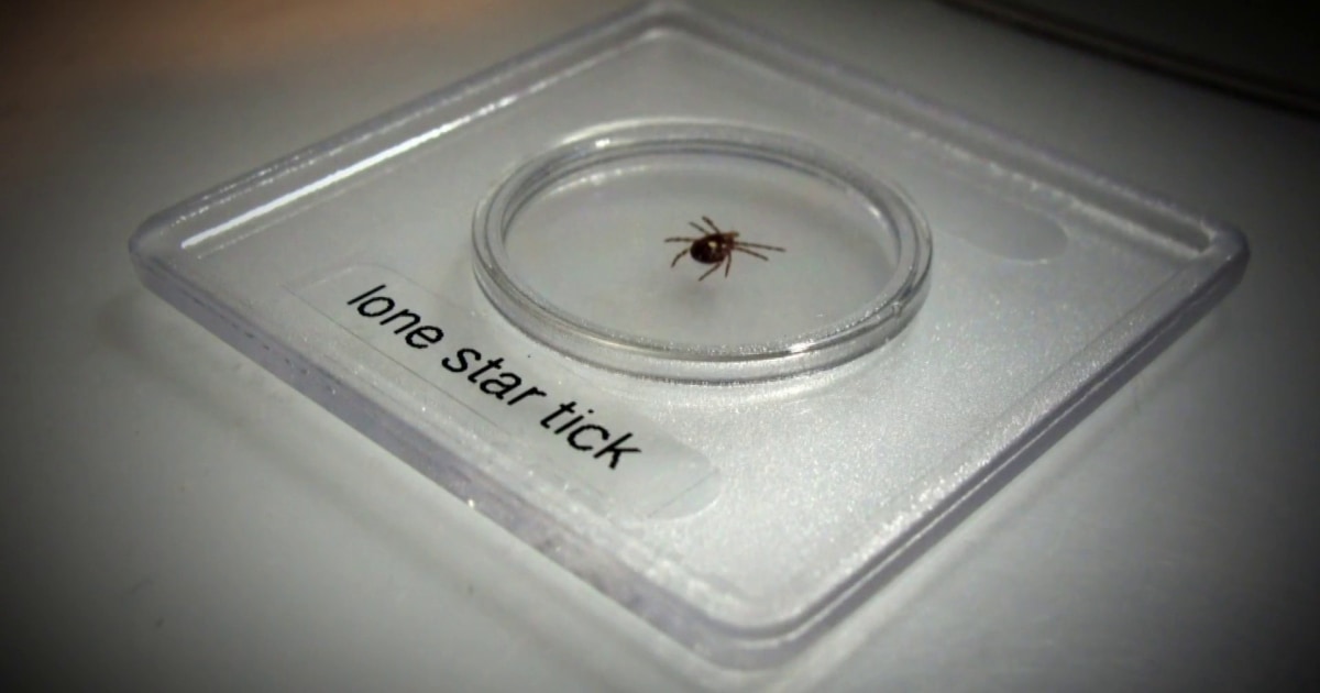 Alpha-gal syndrome has afflicted thousands, CDC says 42% of doctors ...