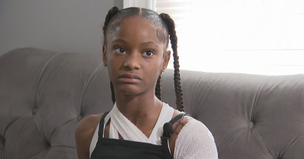 Detroit 11-year-old burned in playground acid attack