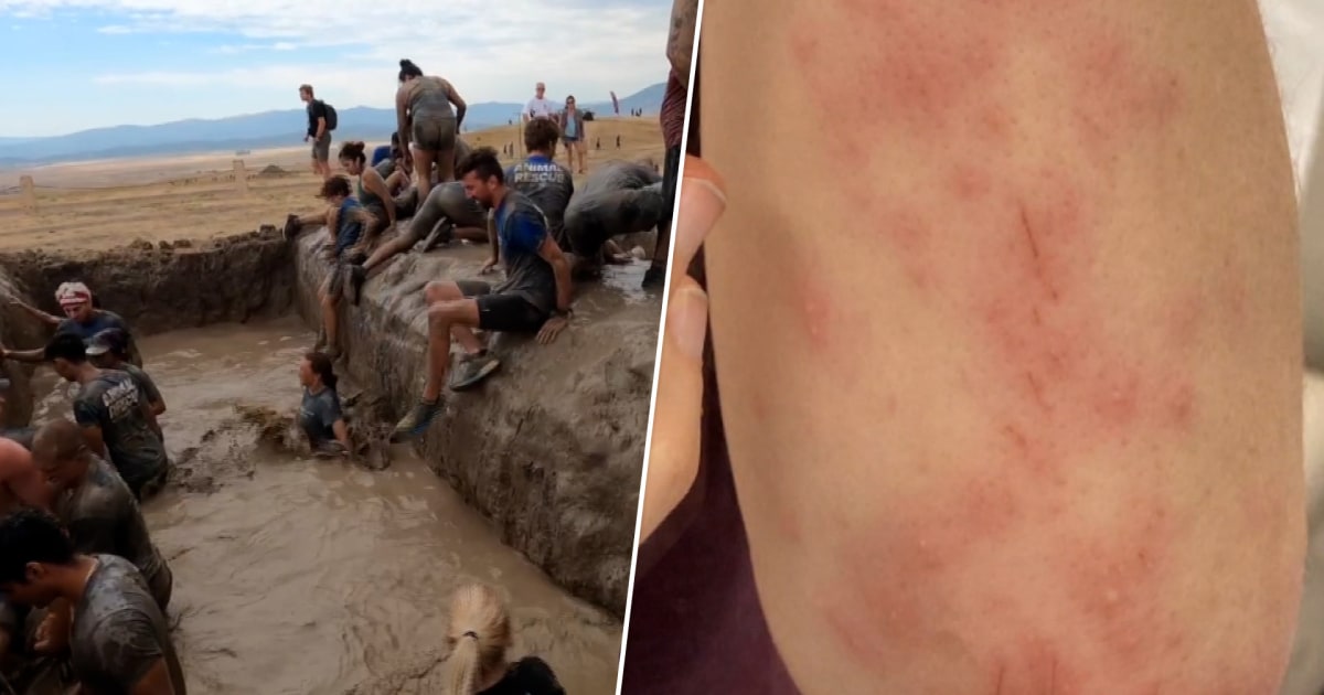 Dozens report rashes and fevers after California Tough Mudder event