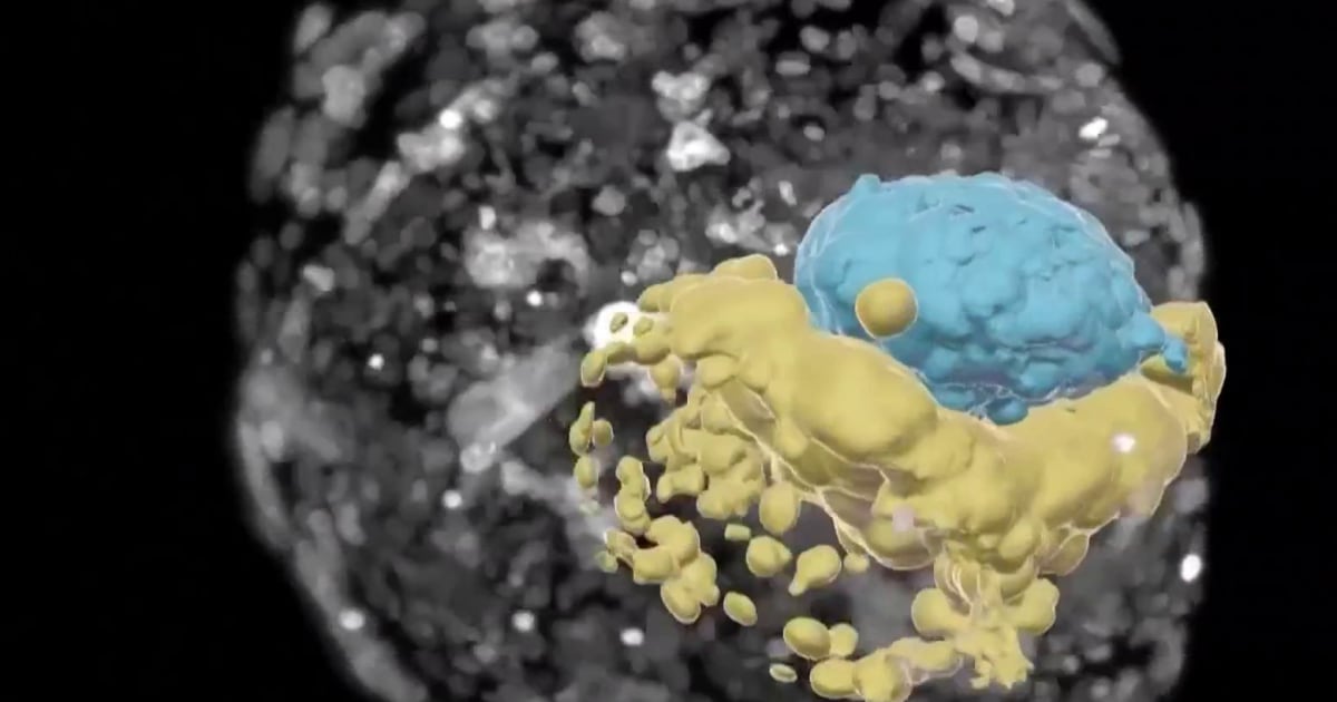 Israeli Scientists Create Human Embryo Model Without Using Sperm Or Eggs