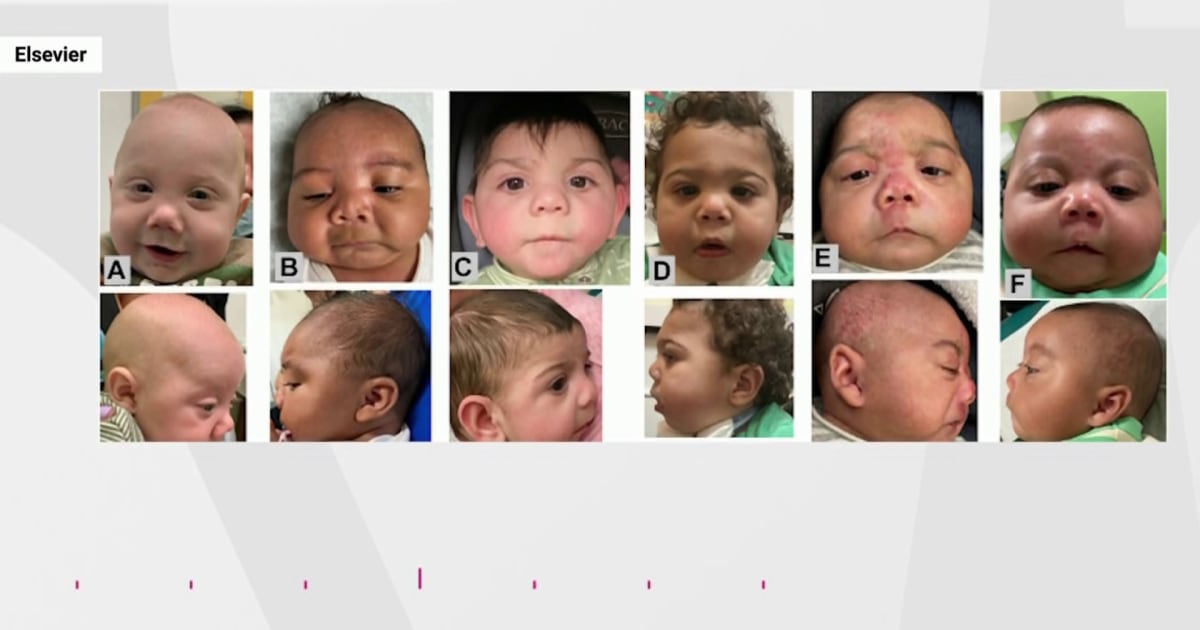 Fentanyl exposure during pregnancy possibly linked to new medical ...