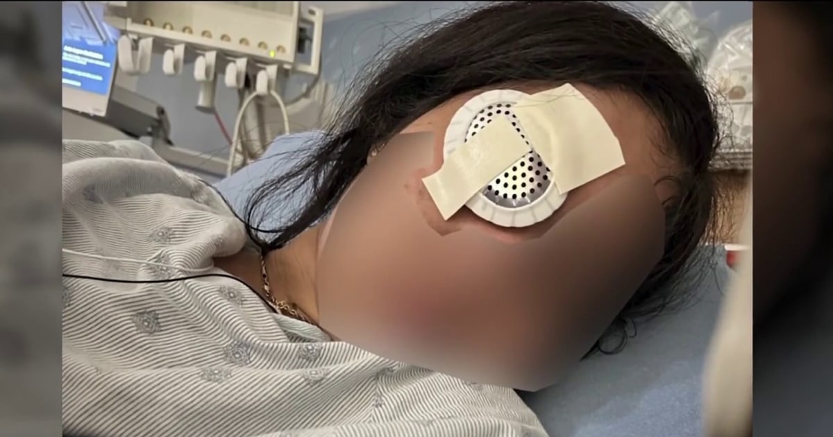 California student injured after shot in eye by water bead gun