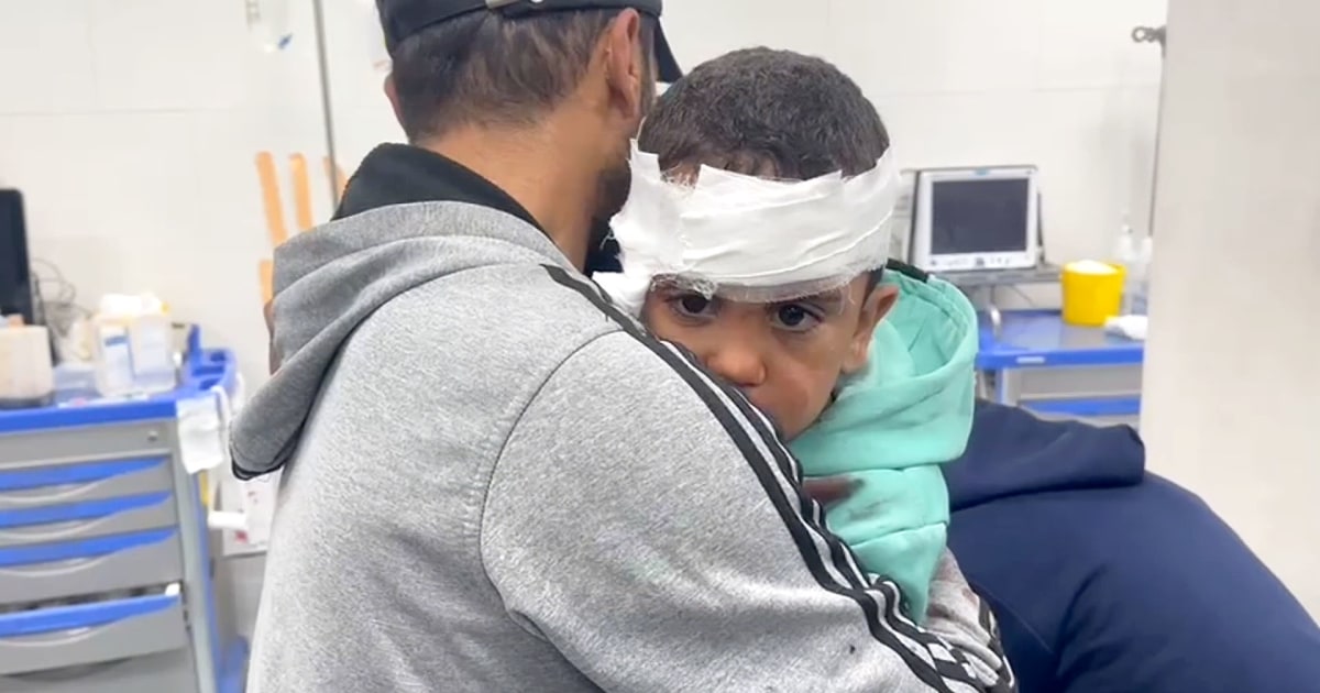 Wounded children treated at Gaza hospital after Rafah airstrike