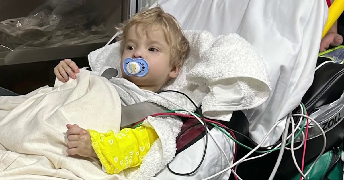 First split liver transplant performed at NYU Langone