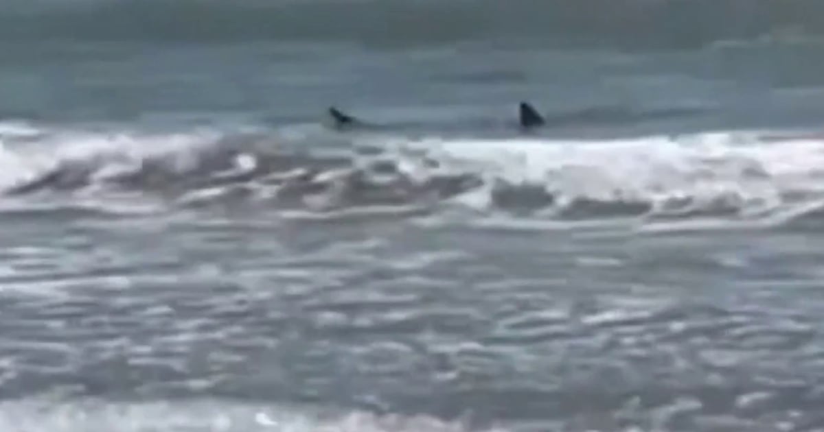 Texas shark attack survivor speaks out