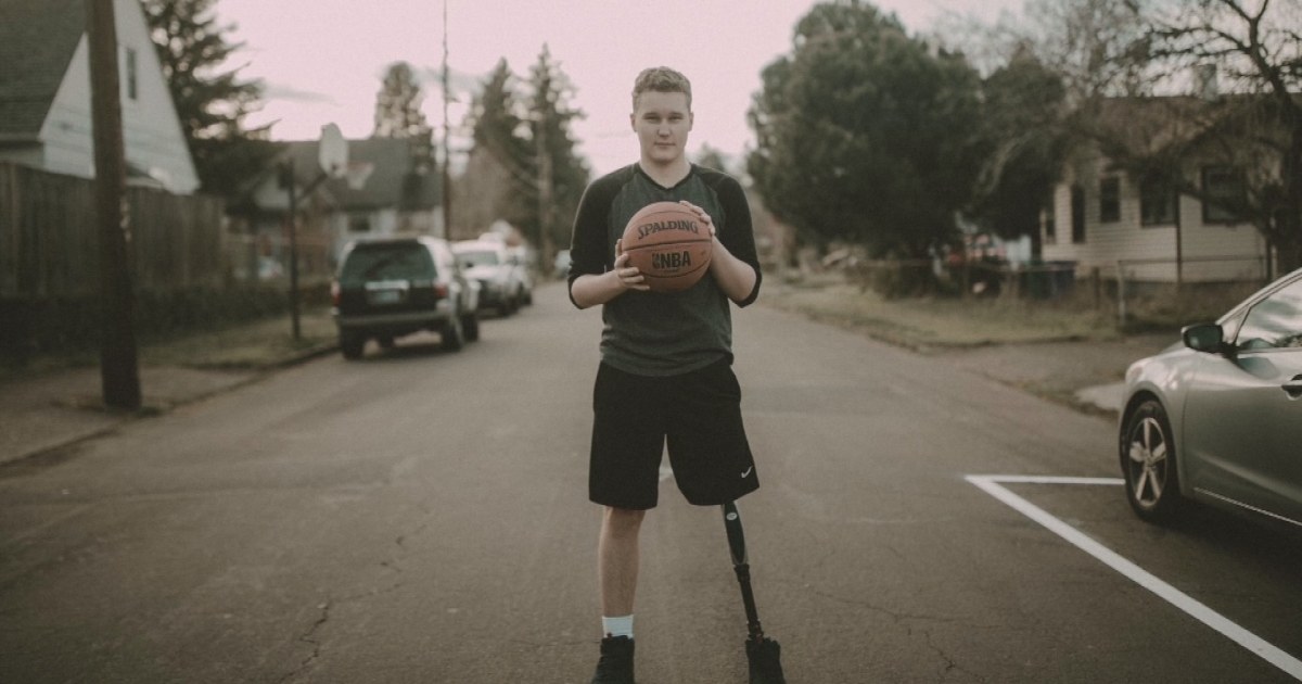 Oregon teen hopes for return of stolen prosthetic leg