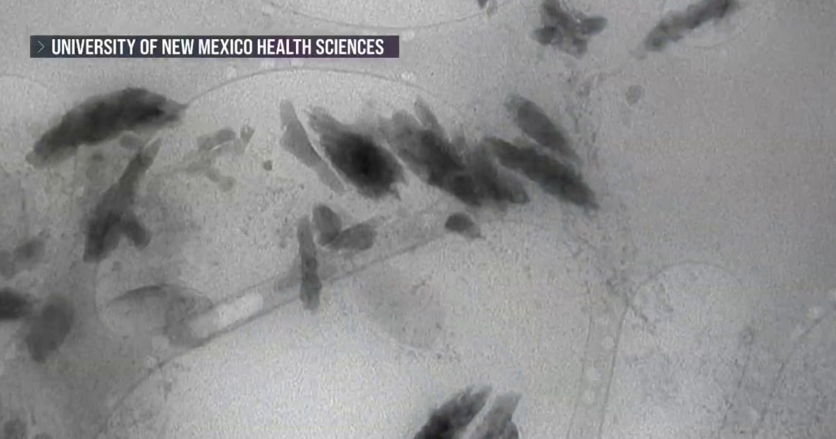 Study finds high levels of plastics in people's brains