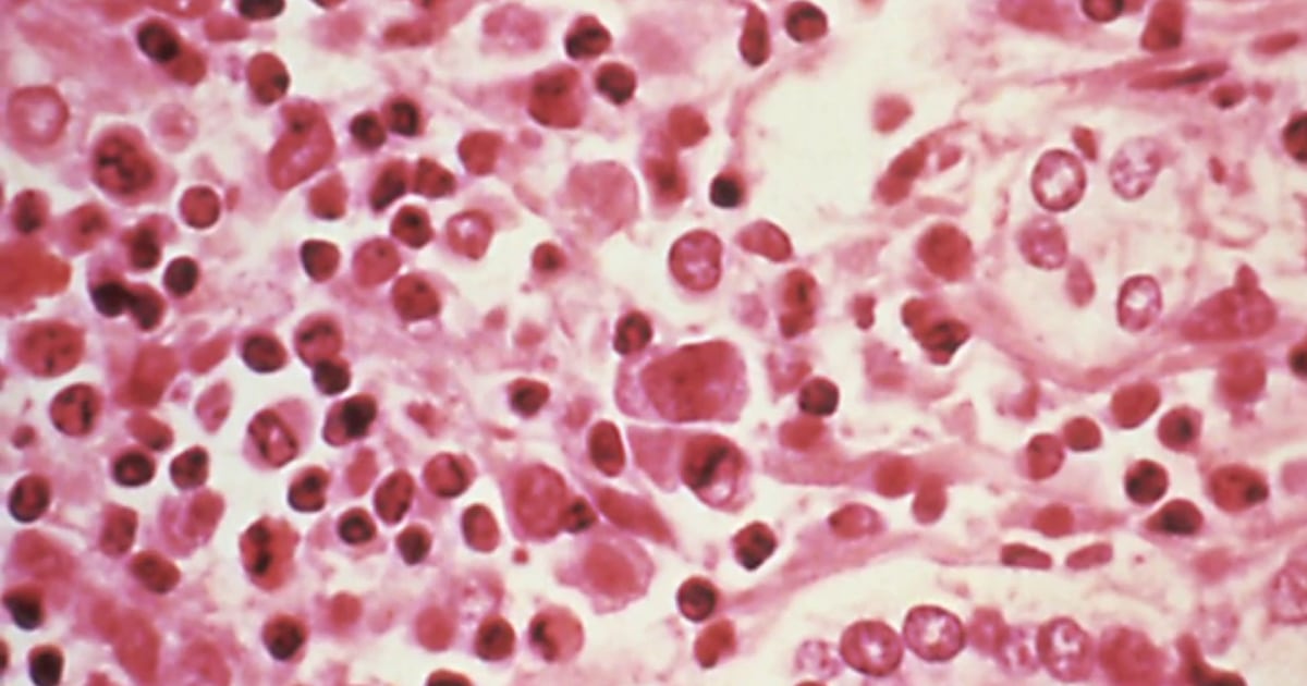 What is the hantavirus?