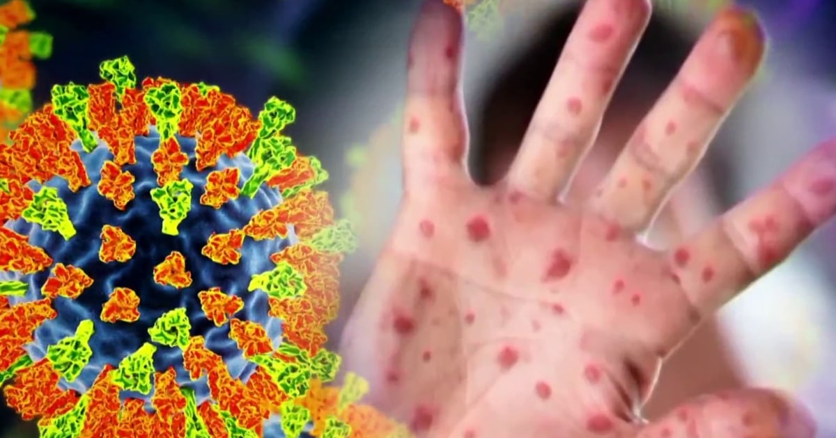 Mounting measles cases drive concerns in schools as hundreds quarantine