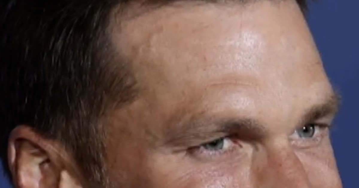 Tom Brady reveals his dog is a clone of his late pet