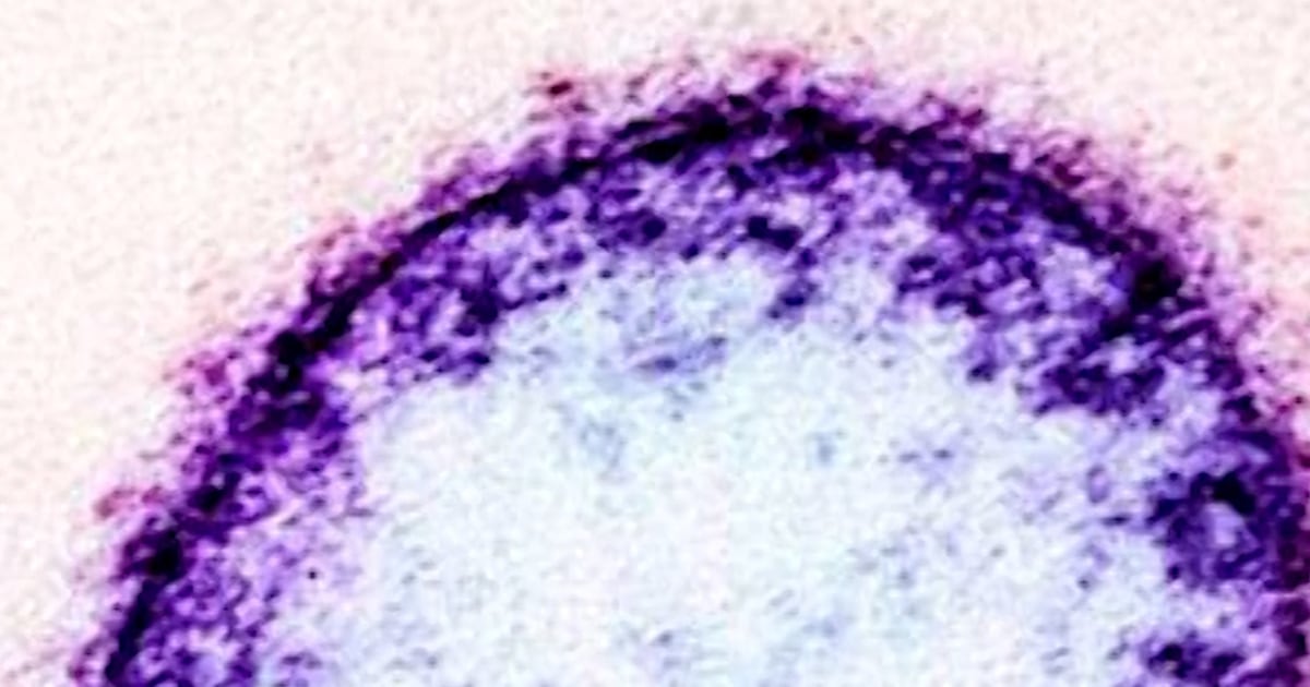 India says it has contained Nipah virus outbreak