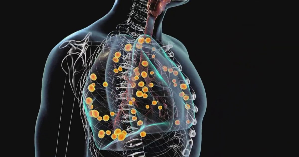 Mysterious illness sickens dozens in Tennessee
