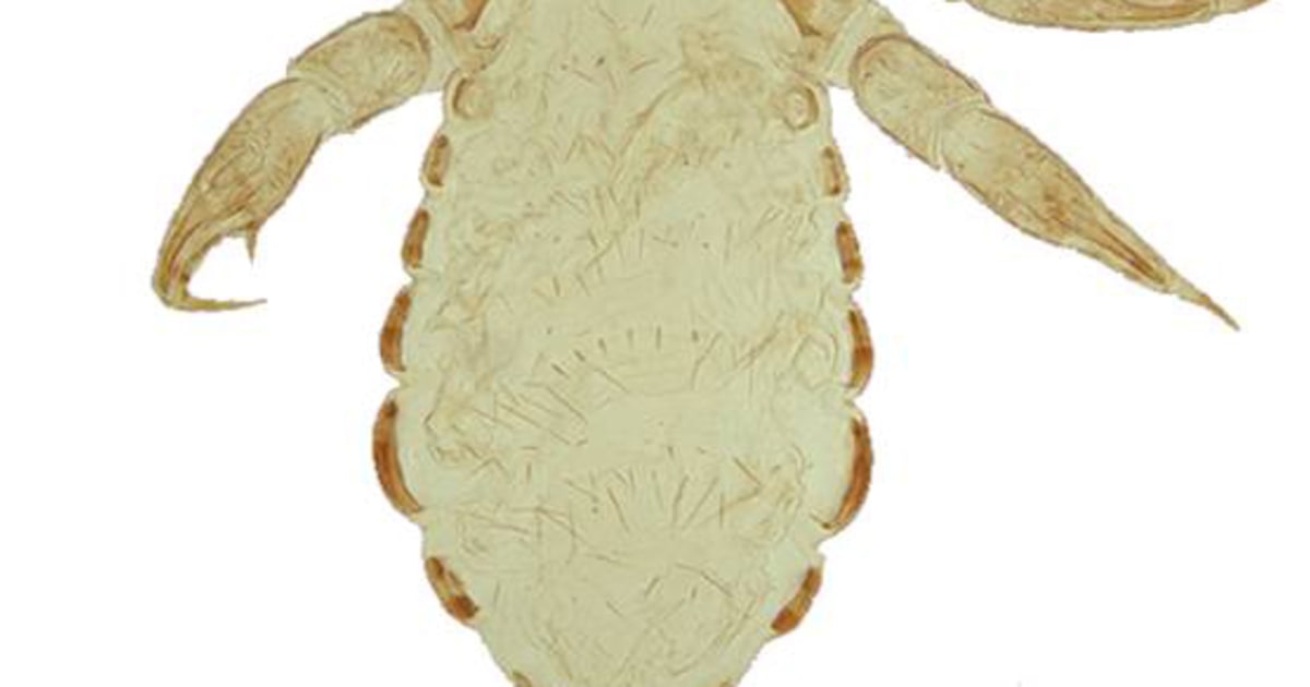 Head lice trace our migration from Africa