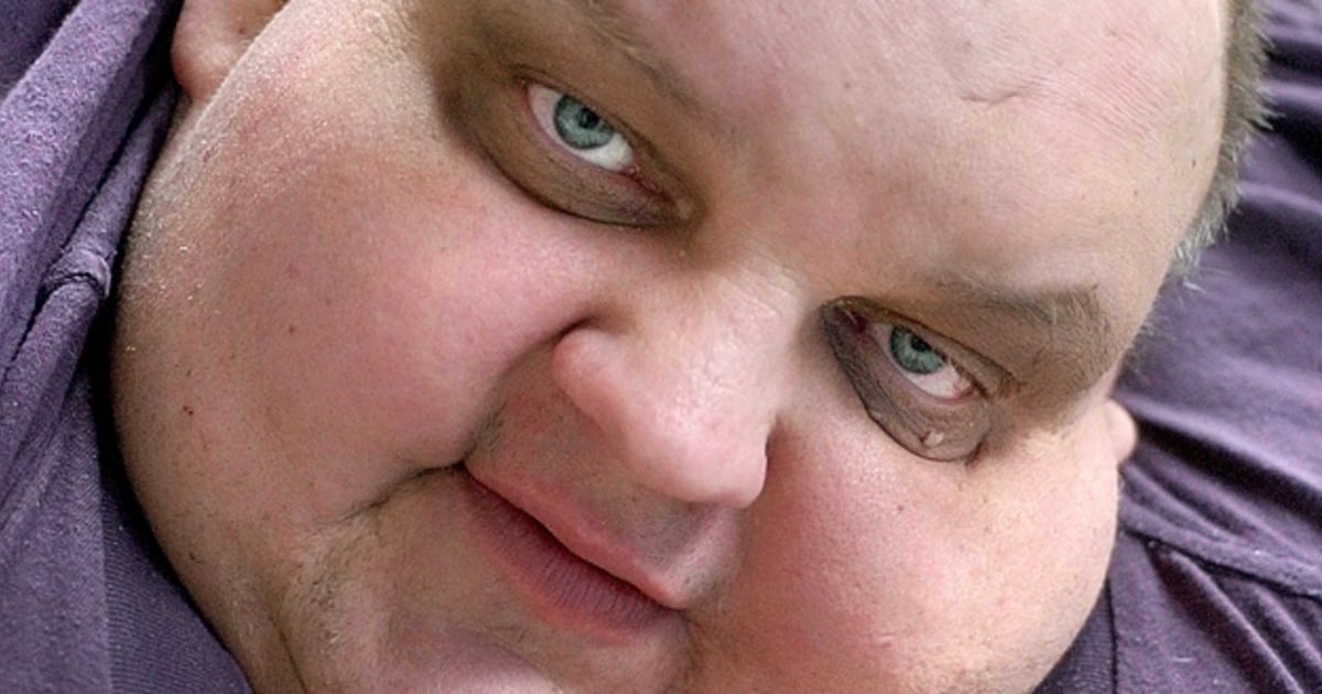 Doctors treat man who weighed 1,000 pounds