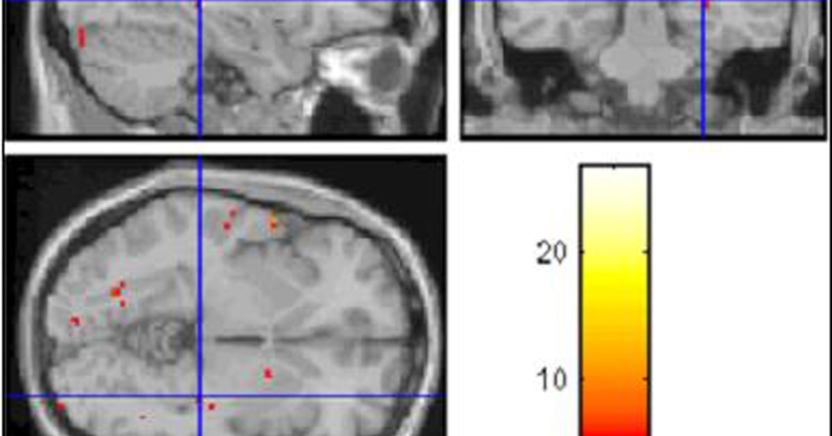 Brain scans detect more activity in those who lie
