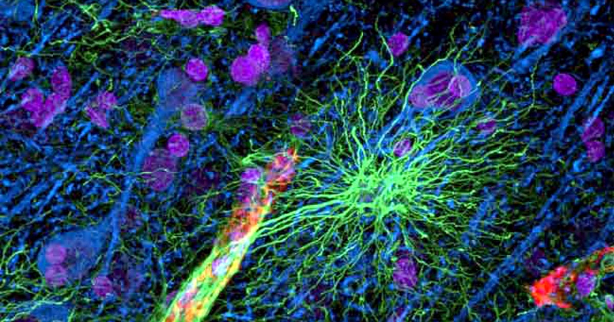 Hard-to-get brain cells grown in the lab at last