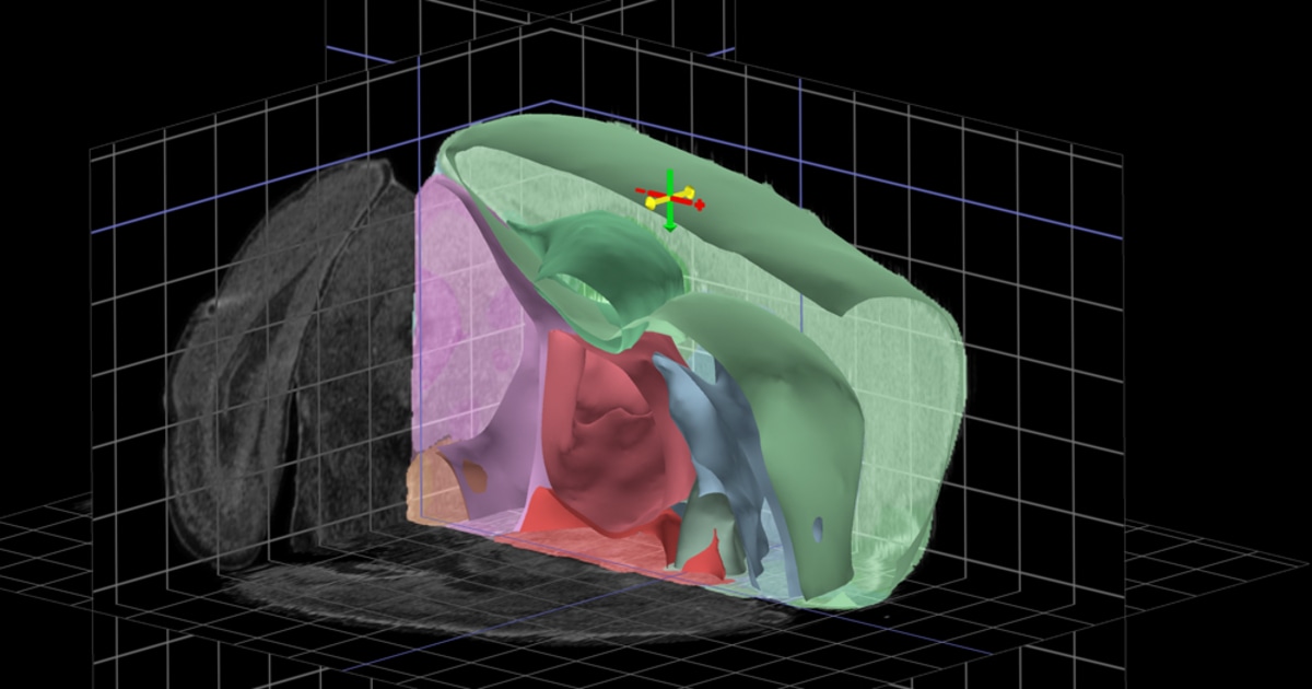 Institute unveils full atlas of mouse brain