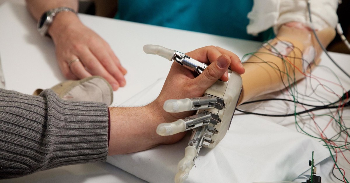 New Bionic Hand Restores Sense of Touch