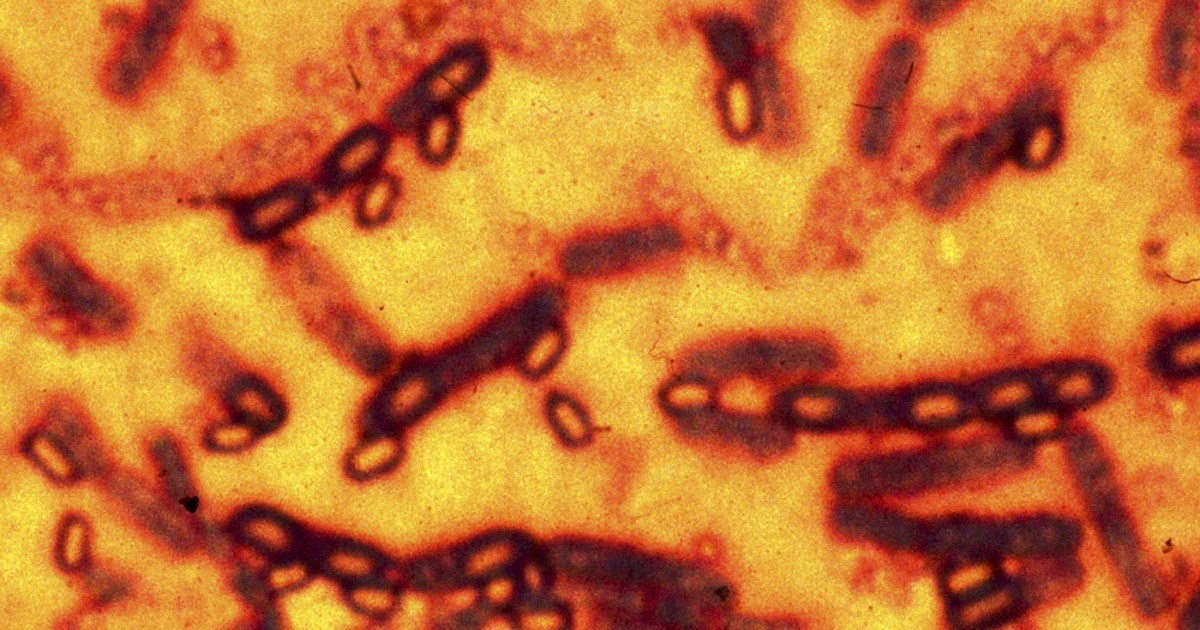 Anthrax in Beef Hospitalizes Five in Hungary