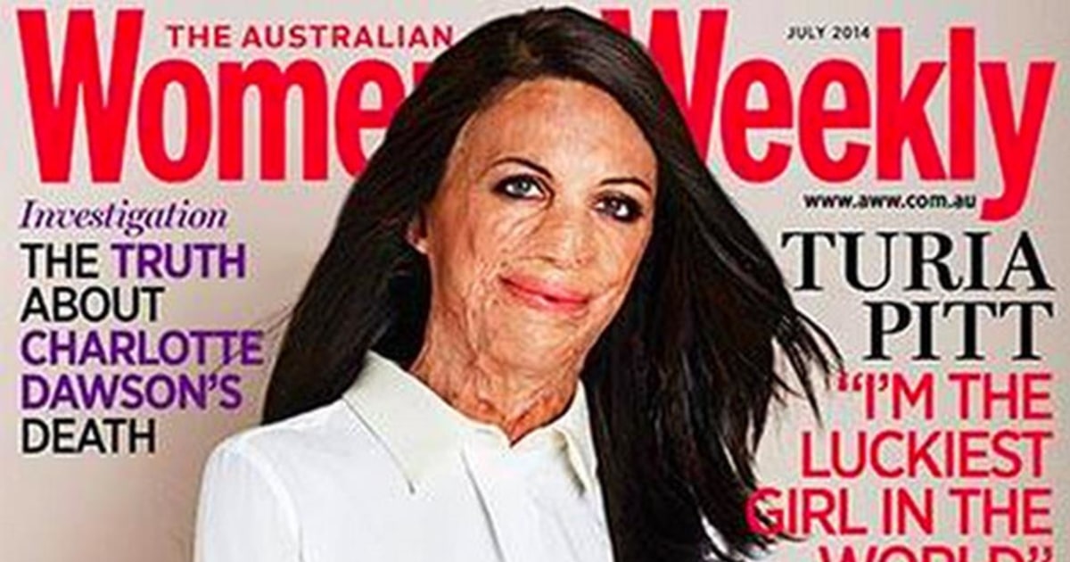 Inspired By Turia Pitt