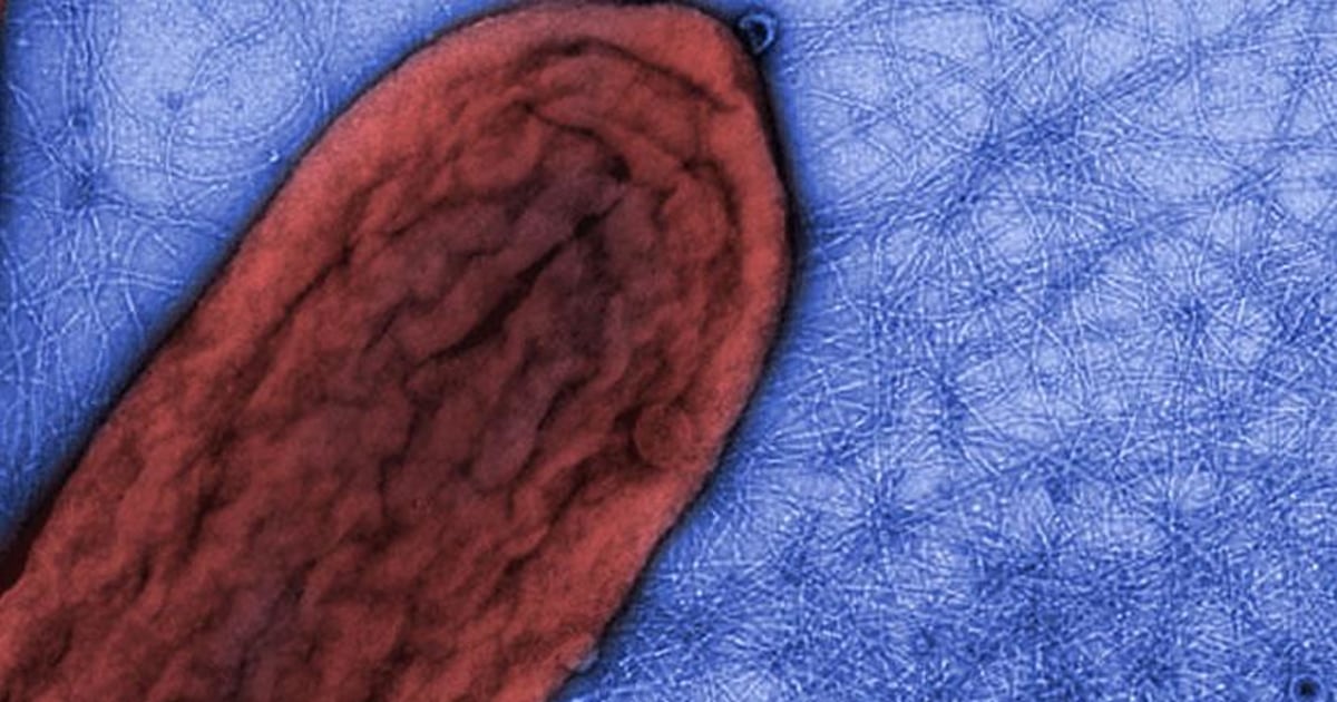 Electric Bacteria? Here's How to Put Electron-Gobblers to Work