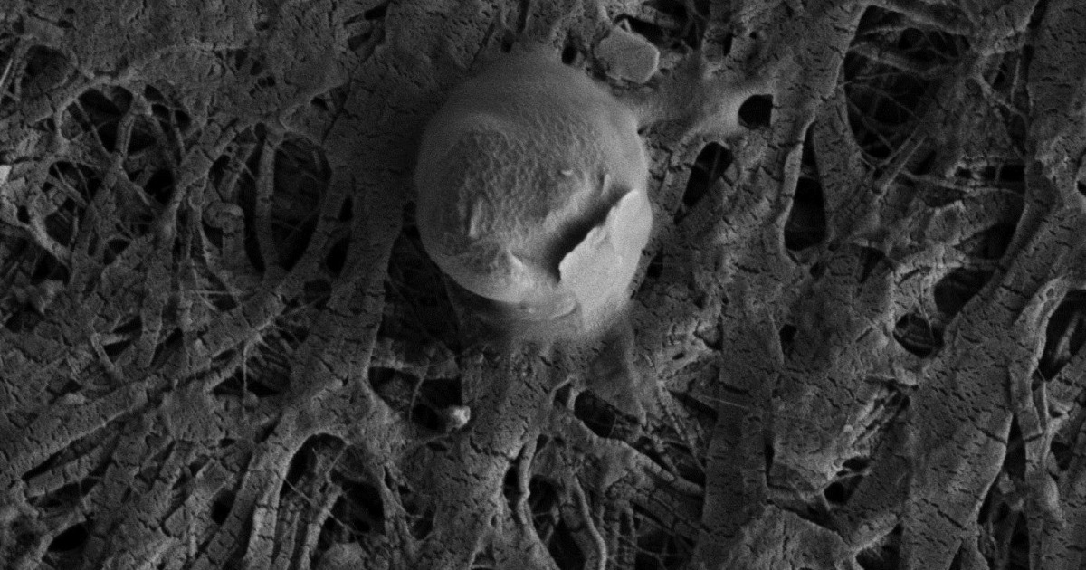 It's Alive! Microbes Discovered Deep Beneath Antarctic Ice