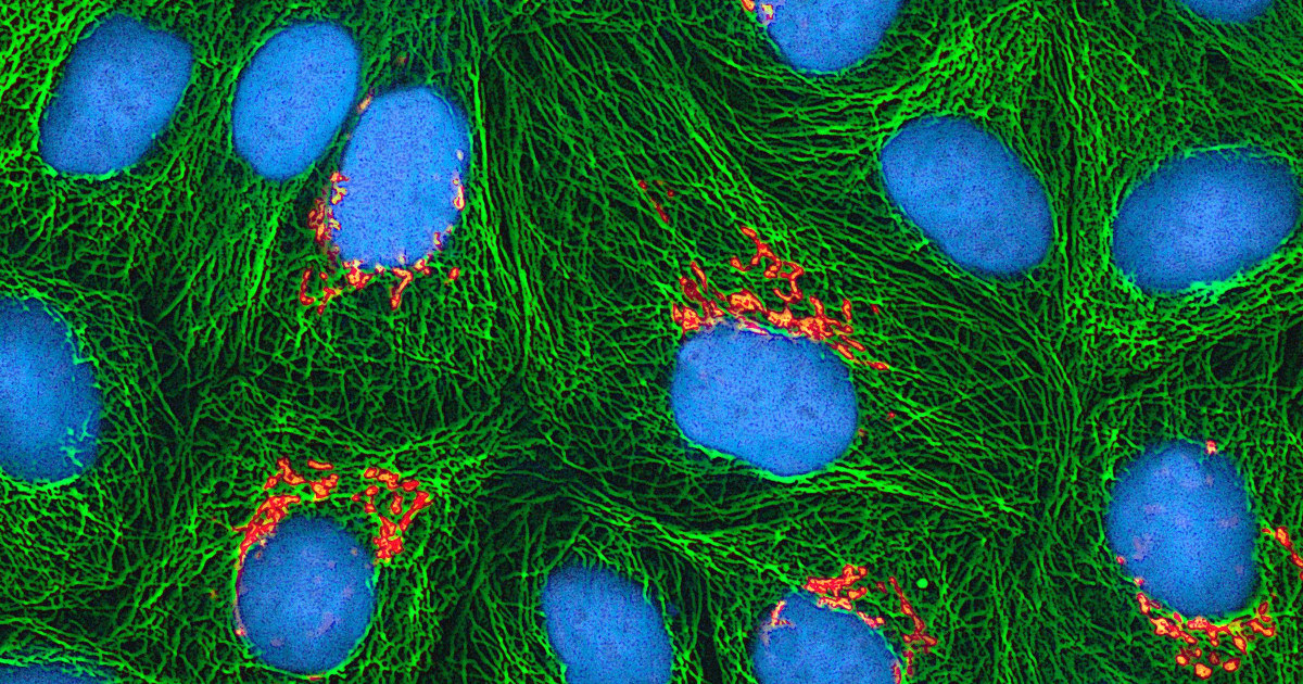 Nobel Chemistry Prize Focuses on Revolution in Microscope Resolution