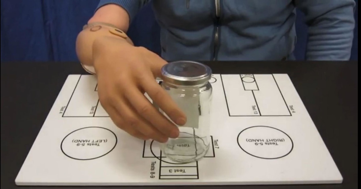 New Technique Gives Men Bionic Hands