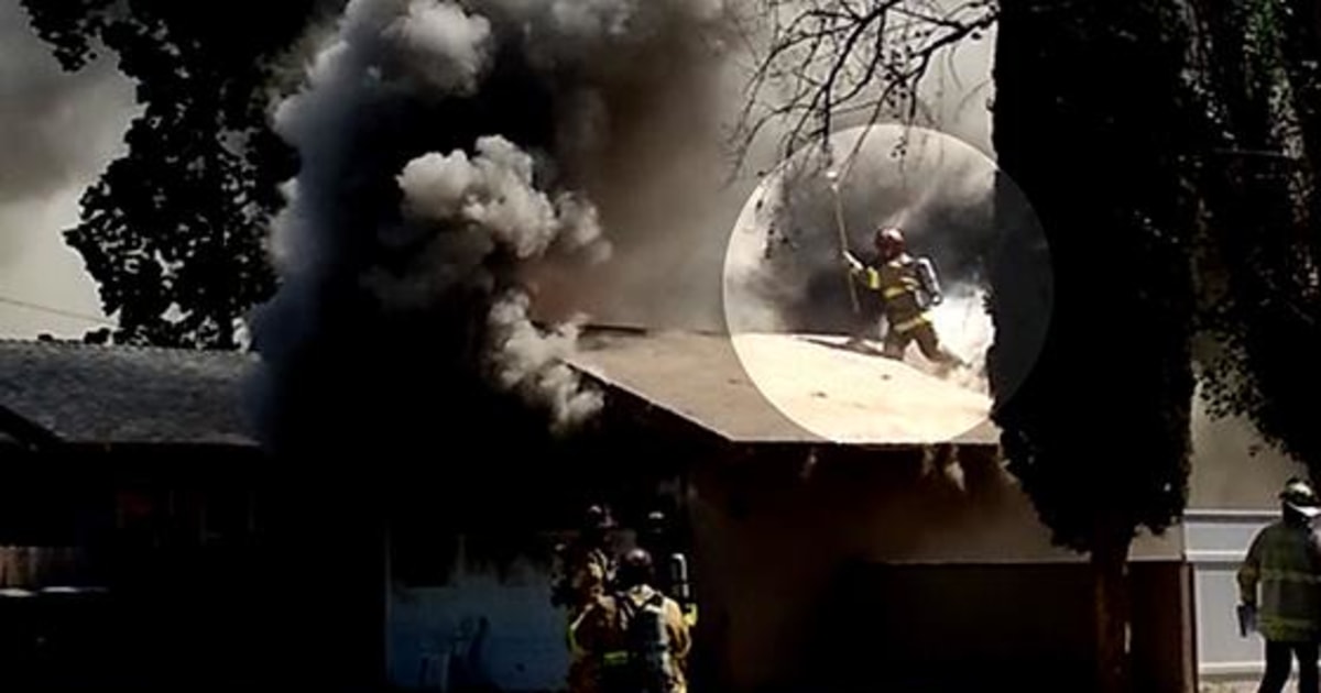 Badly Burned Fresno Firefighter Pete Dern 'Smiling' After Latest Surgery