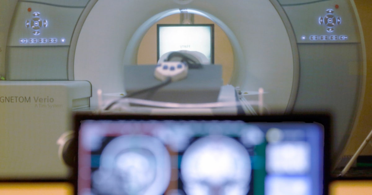 Brain Scans May Predict Math Gains in Children, Study Finds