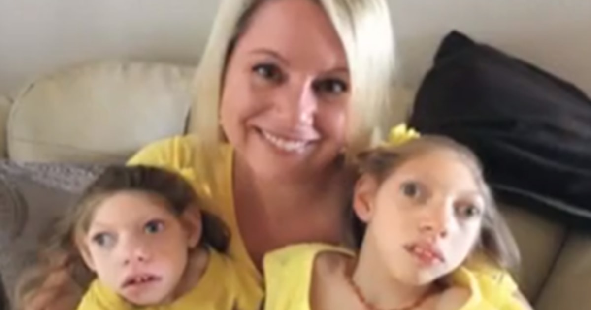 'Love & Happiness': Raising Kids With Microcephaly