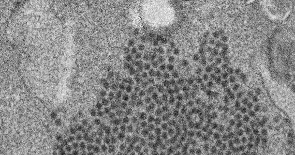 Cases of polio-like paralysis appear to have peaked, CDC says
