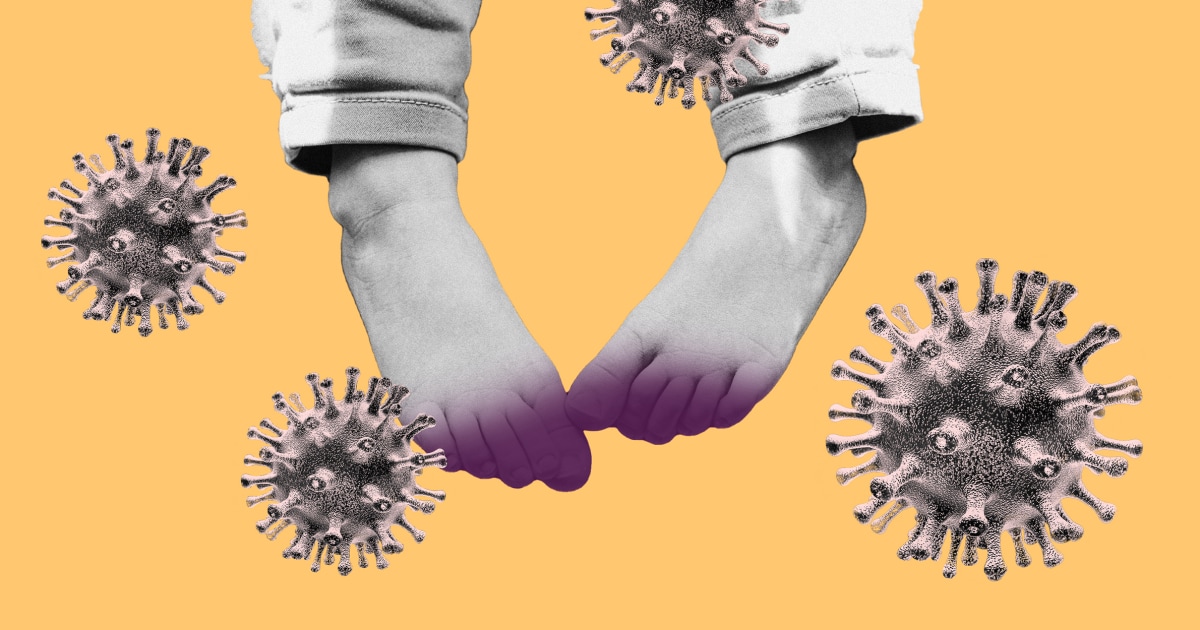 Covid toes could last for 150 days, new research finds