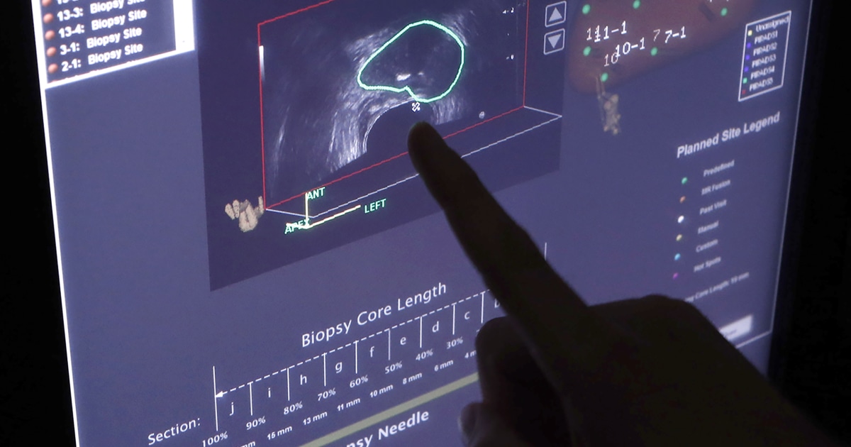 FDA approves new imaging tool to find advanced prostate cancer