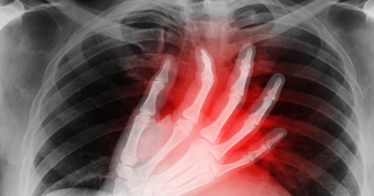 Por qué el estrés es malo para el corazón y cómo evitar que lo dañe