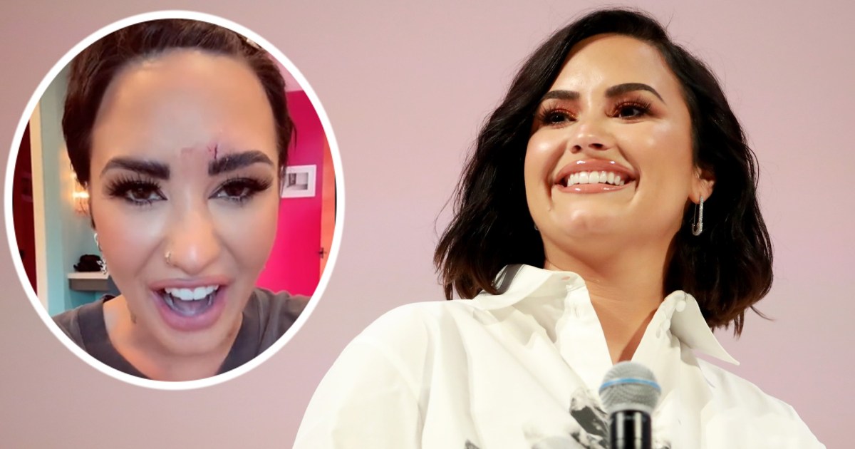 Demi Lovato sufre accidente y muestra en video su herida abierta en la ...