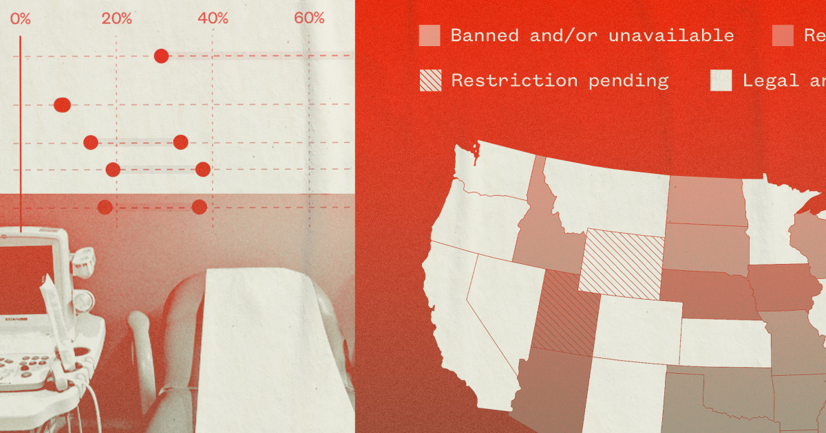 America after Dobbs: Abortion access a year after Roe v. Wade is overturned