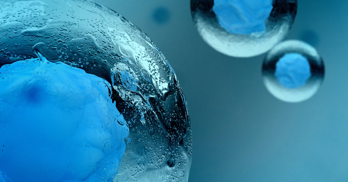 A European man could be cured of HIV thanks to a stem cell transplant ...