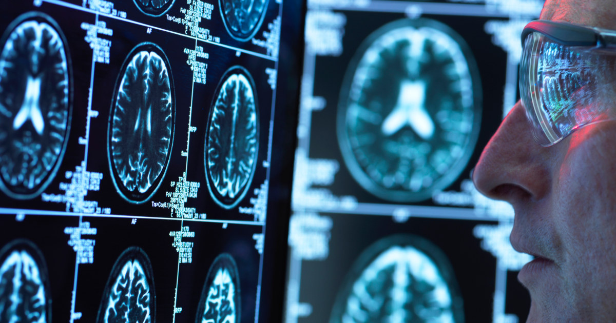 Para curar a una niña que sufre una enfermedad neurológica, los ...