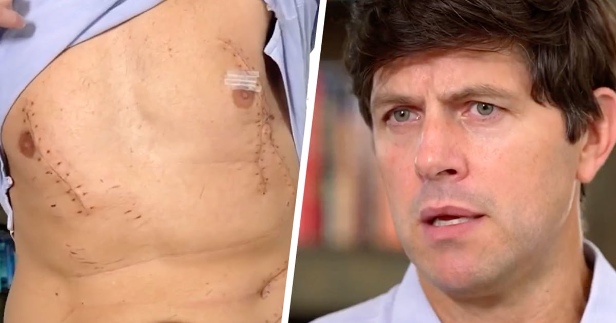 California shark attack survivor recalls 'tussling' with animal and ...